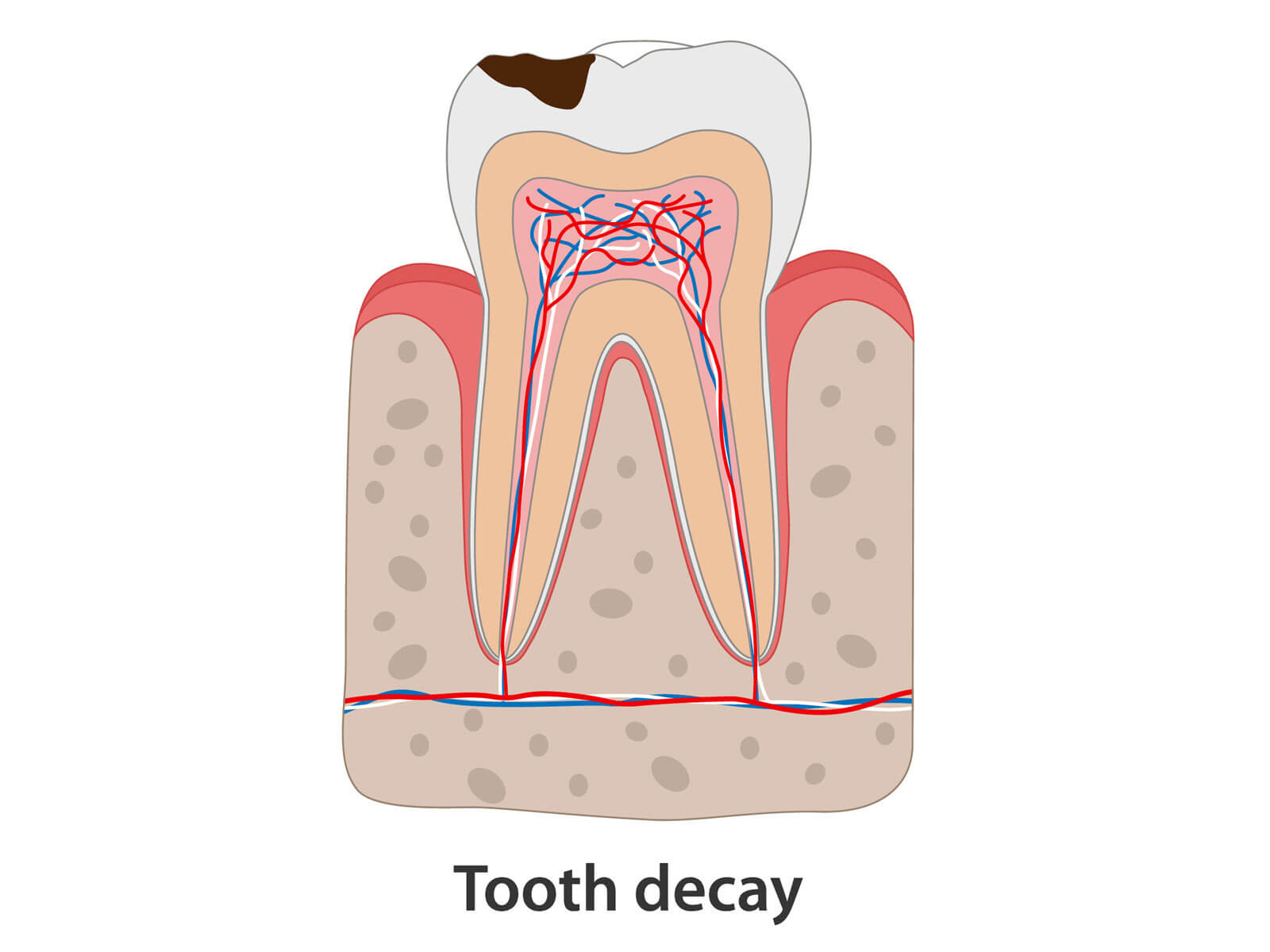 The Role of Fluoride In Protecting Teeth From Decay
